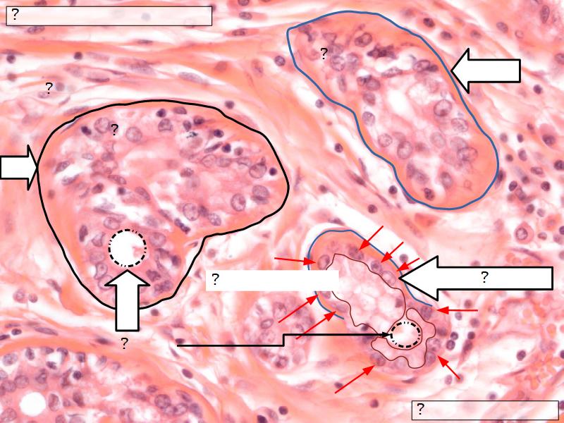 Mammary gland and Nipple
