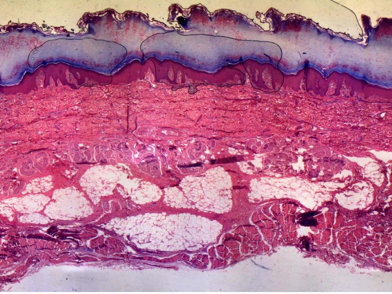 Epithelia and Connective Tissues