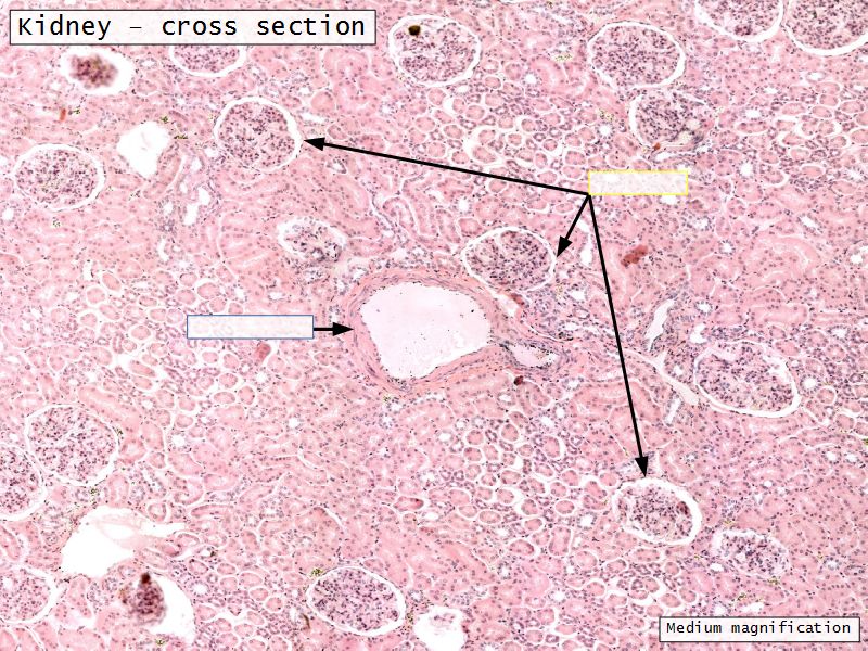 Slides 28 and 76: Kidney