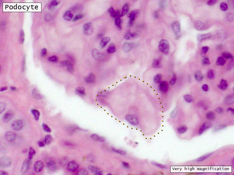 Slides 28 and 76: Kidney