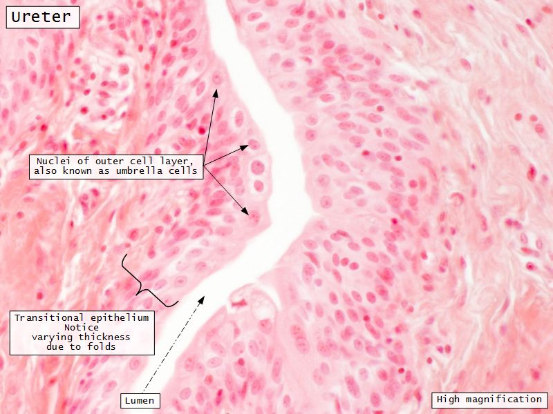 Slides 78 and 79: Ureter and Bladder