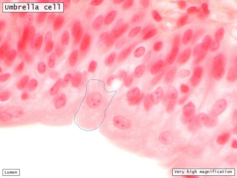 Slides 78 and 79: Ureter and Bladder