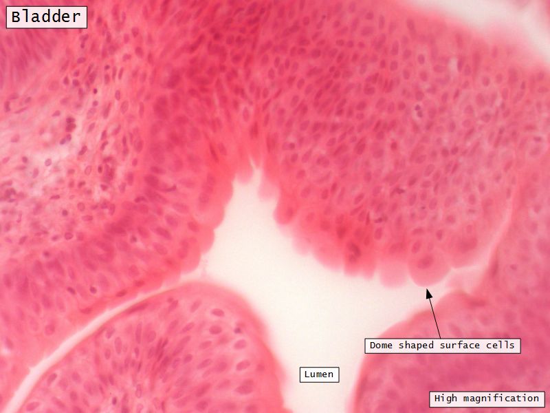 Slides 78 and 79: Ureter and Bladder