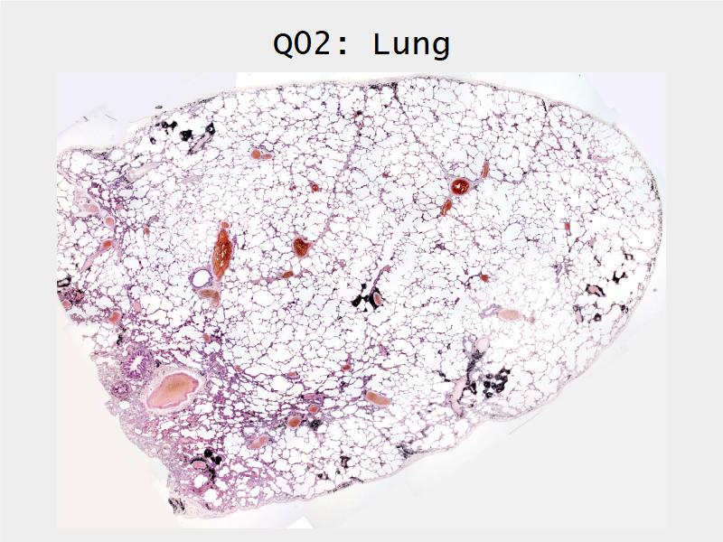 Respiratory System Revision